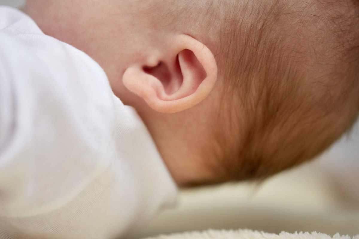 Non-Surgical Ear Molding | Midwest Facial Plastic Surgery